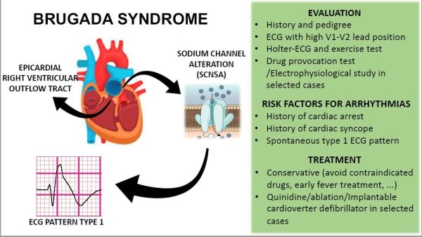 Case Report: Cardiac Arrest in a Child's Structurally Normal Heart ...