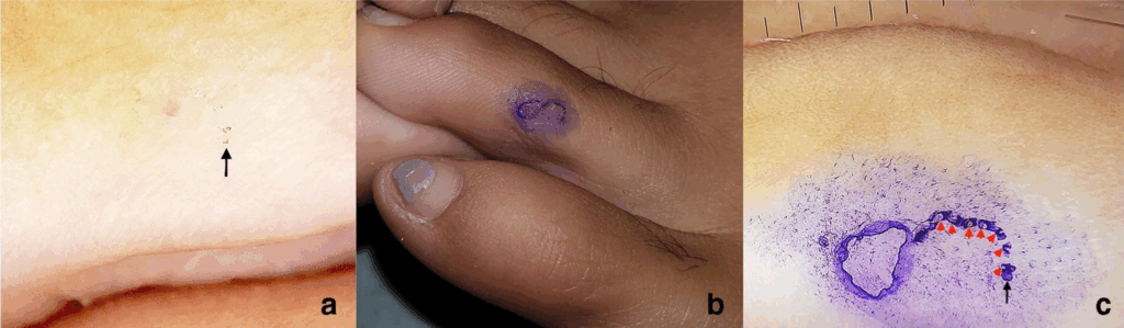 10 Essentials for Your Emergency Department Fanny Pack - ACEP Now